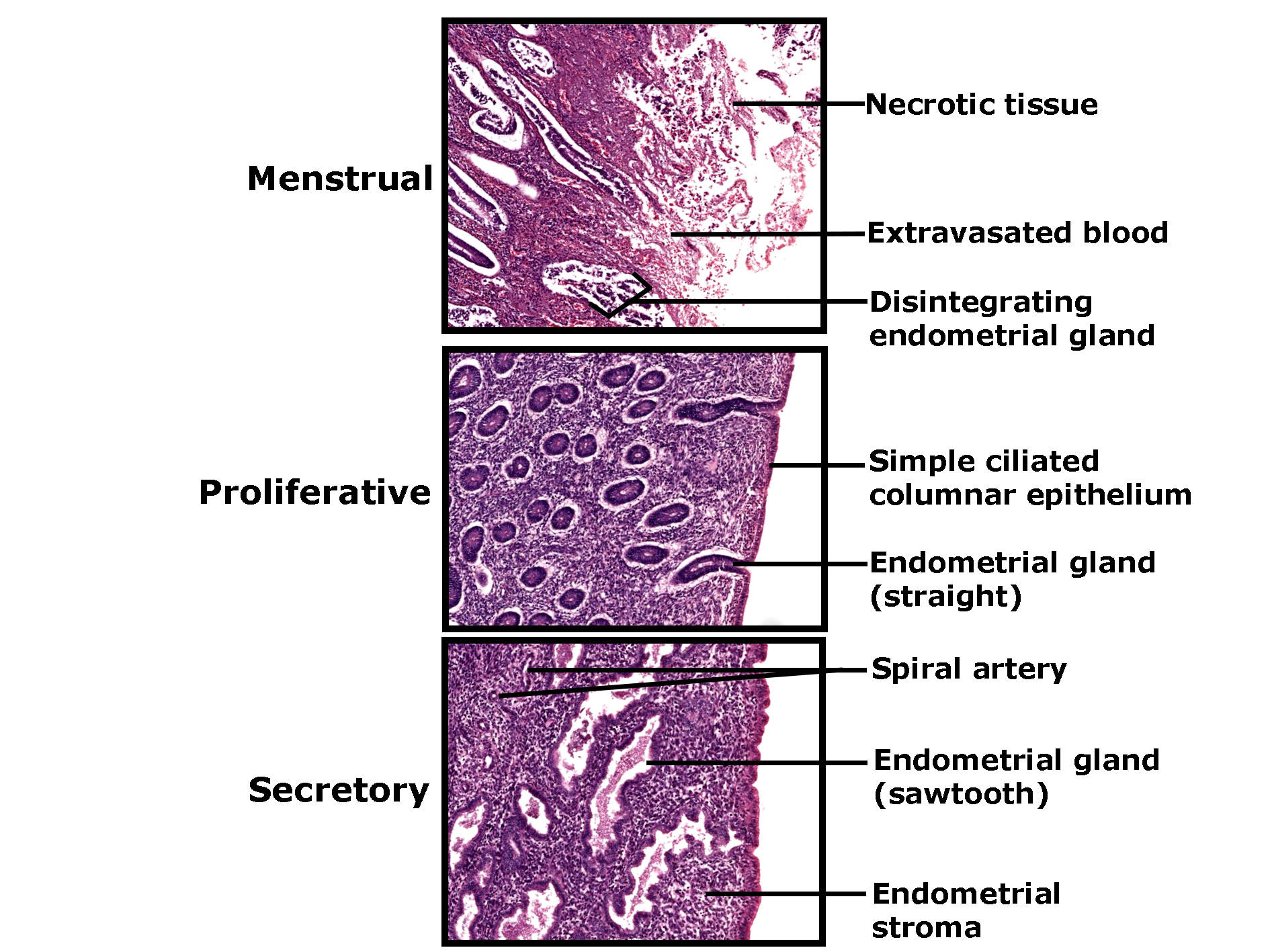 Endometrium: Menstrual, Proliferative, & Secretory Phases | Histology ...